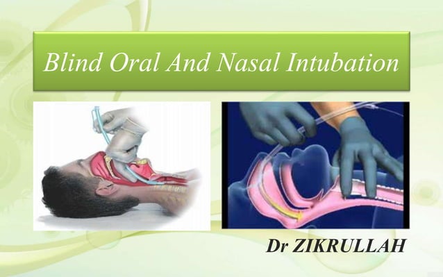 Blind oral and nasal intubation | PPTX | Ear, Nose and Throat ...