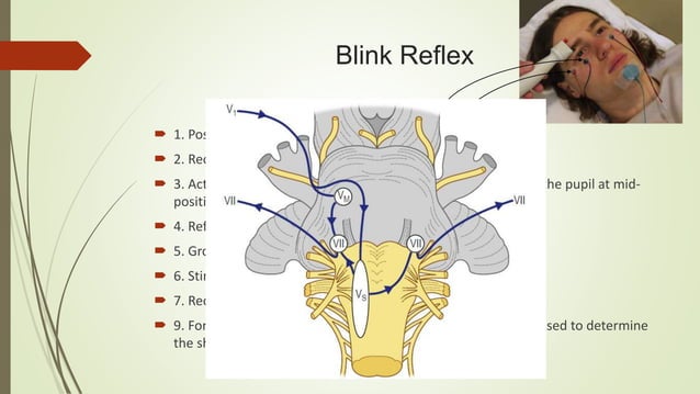 Blink H reflex SFEMG.pptx