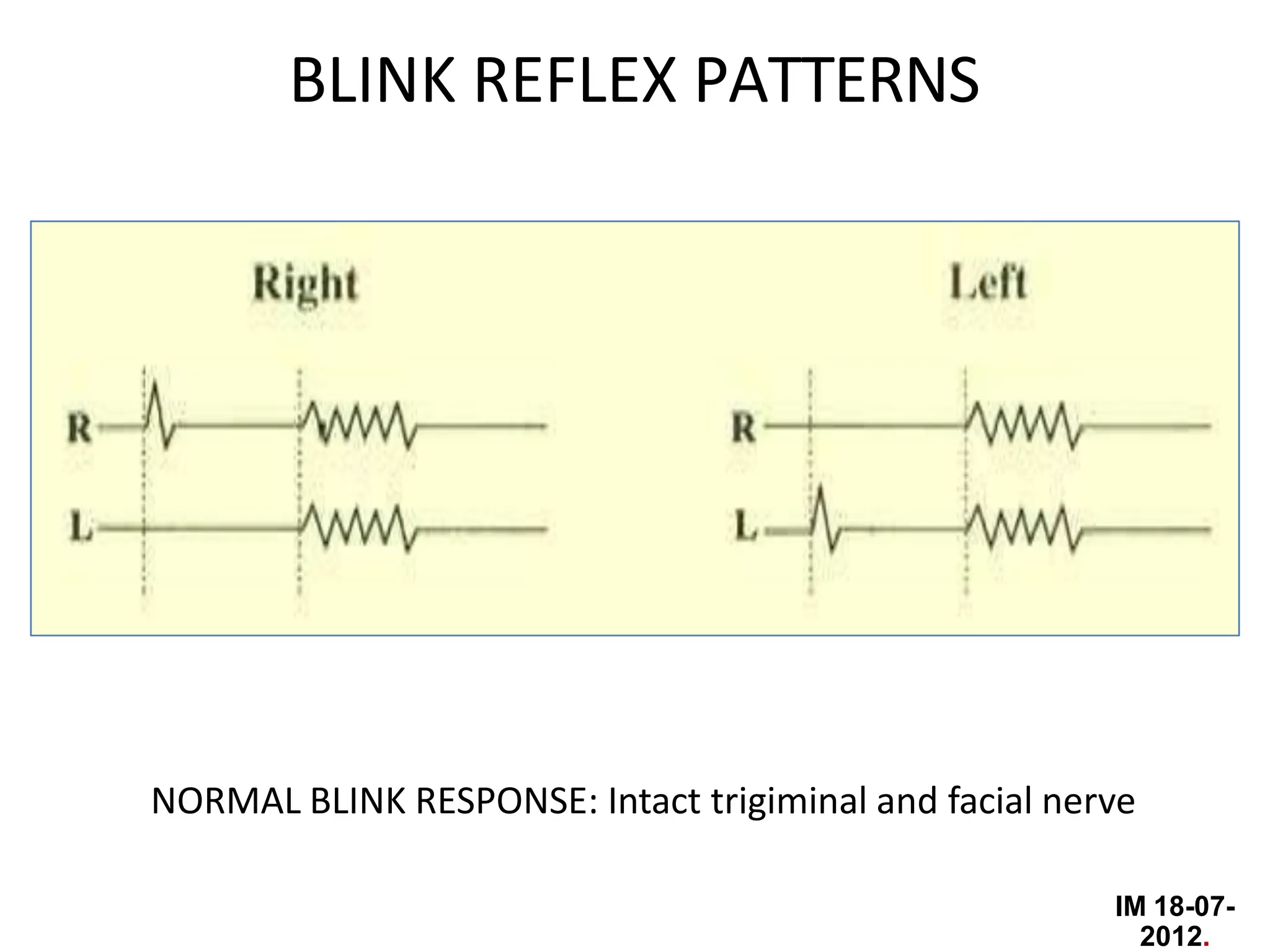 blink reflex nerve conduction velocity test | PPTX