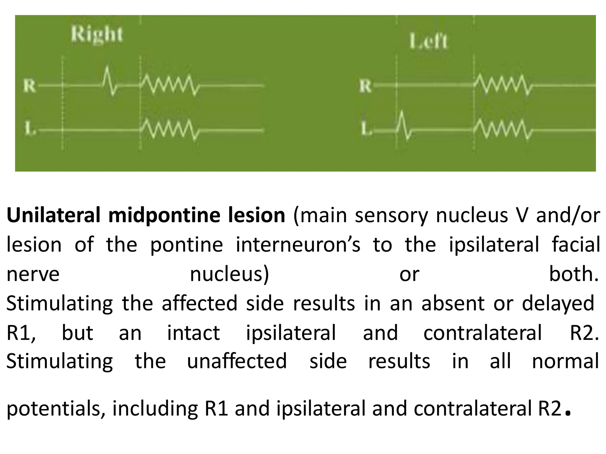 blink reflex nerve conduction velocity test | PPTX
