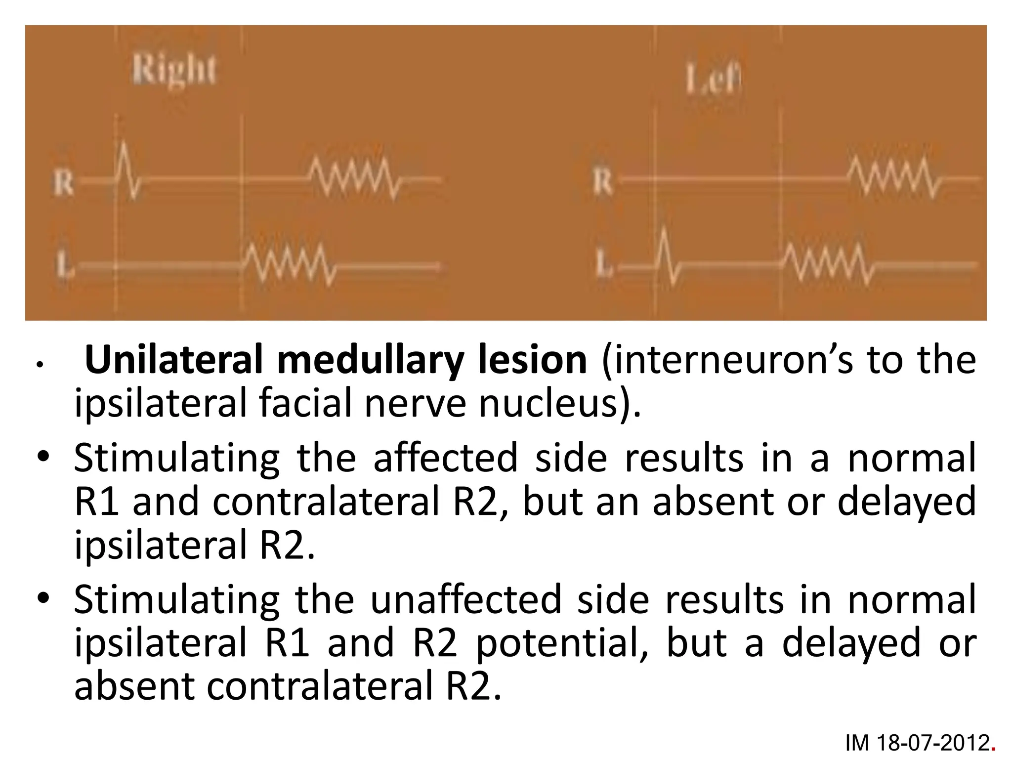 blink reflex nerve conduction velocity test | PPTX
