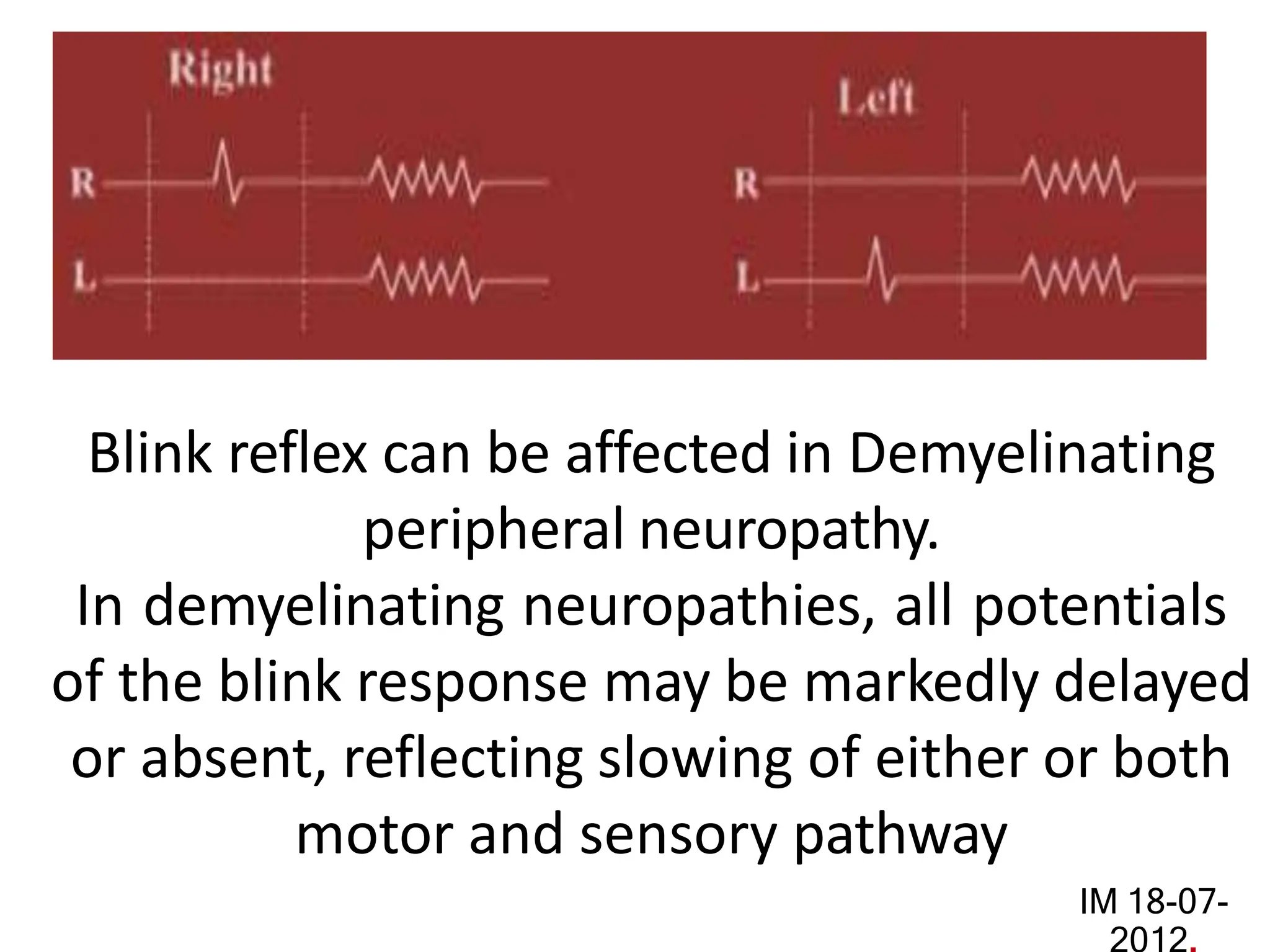 blink reflex nerve conduction velocity test | PPTX