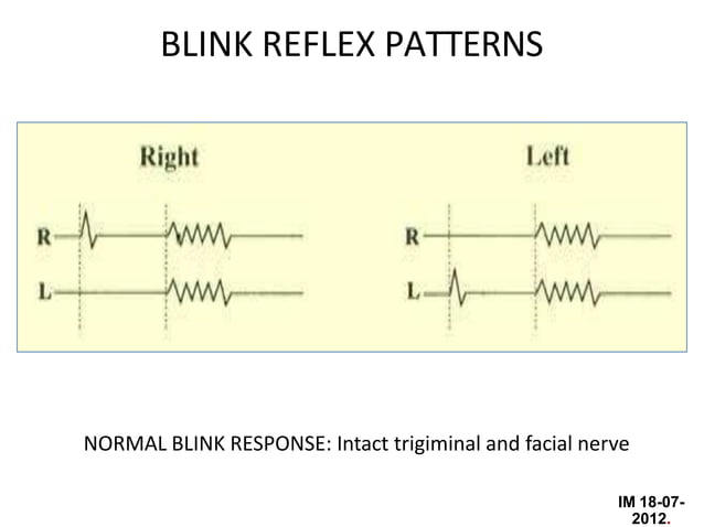 blink reflex nerve conduction velocity test | PPTX | Brain and Nervous ...