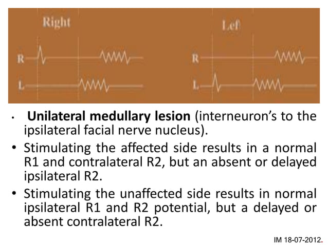 blink reflex nerve conduction velocity test | PPTX | Brain and Nervous ...