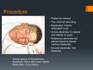 Blink reflex 1 | PPTX