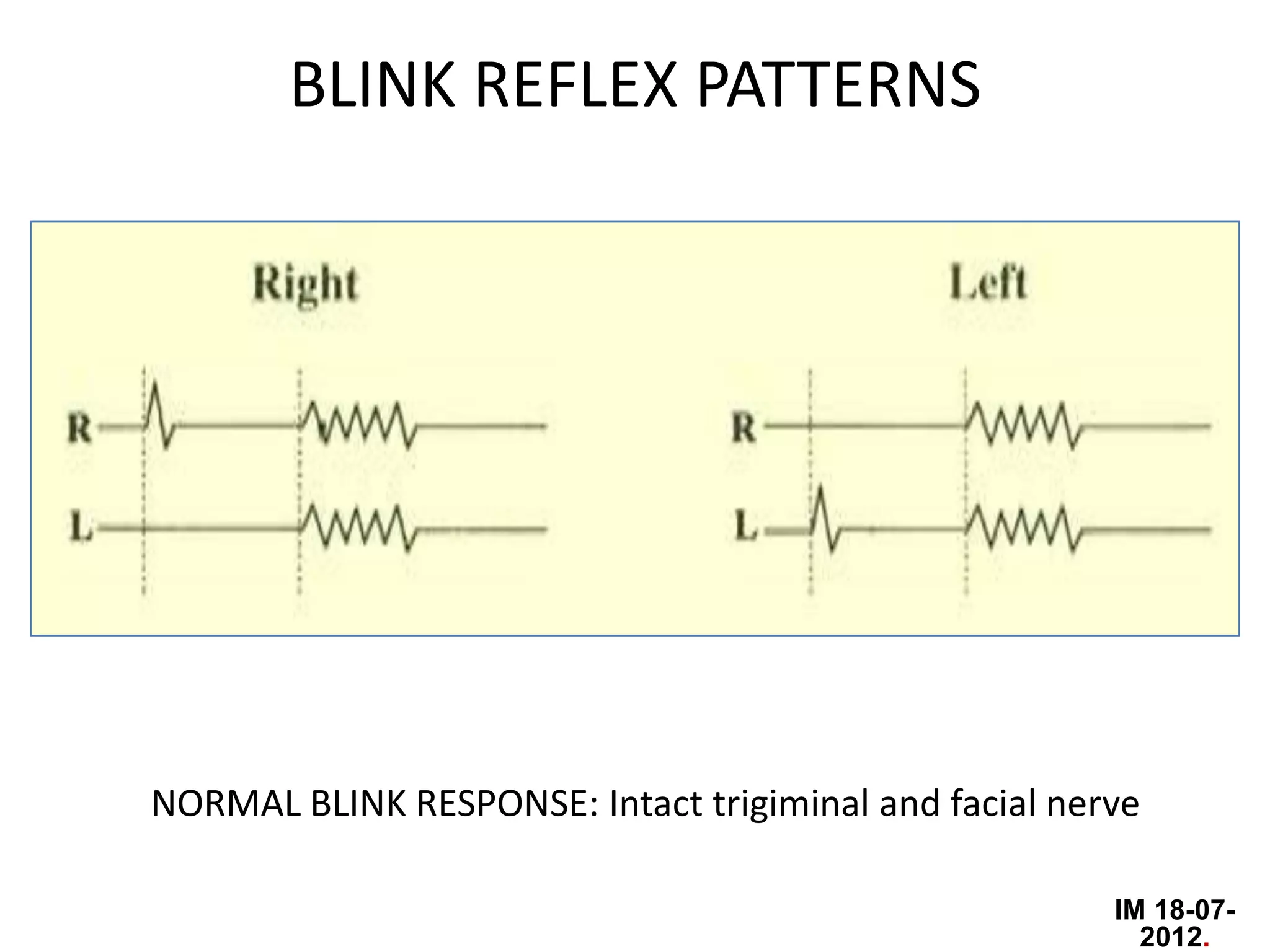 Blink reflex | PPTX