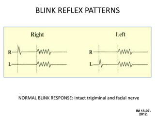 Blink reflex | PPTX