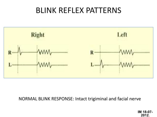 Blink reflex | PPTX | Brain and Nervous System Disorders | Diseases and ...