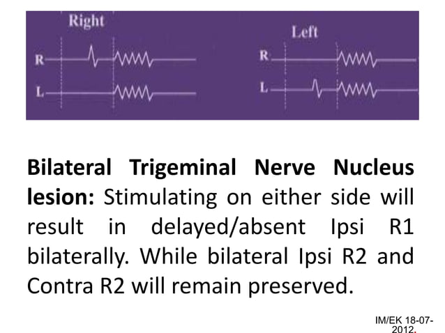 Blink reflex | PPTX | Brain and Nervous System Disorders | Diseases and ...
