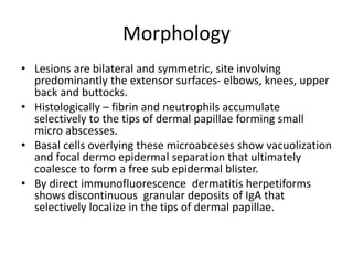 Blistering Bullous Disease by dr shahida kashif | PPTX