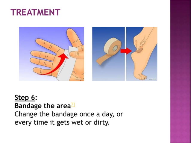 Blisters | PPTX | Skin and Dermatology | Diseases and Conditions