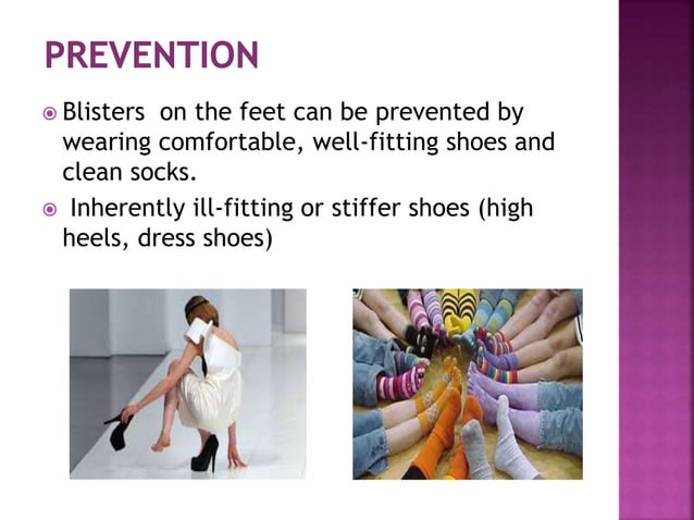 Blisters | PPTX | Skin and Dermatology | Diseases and Conditions