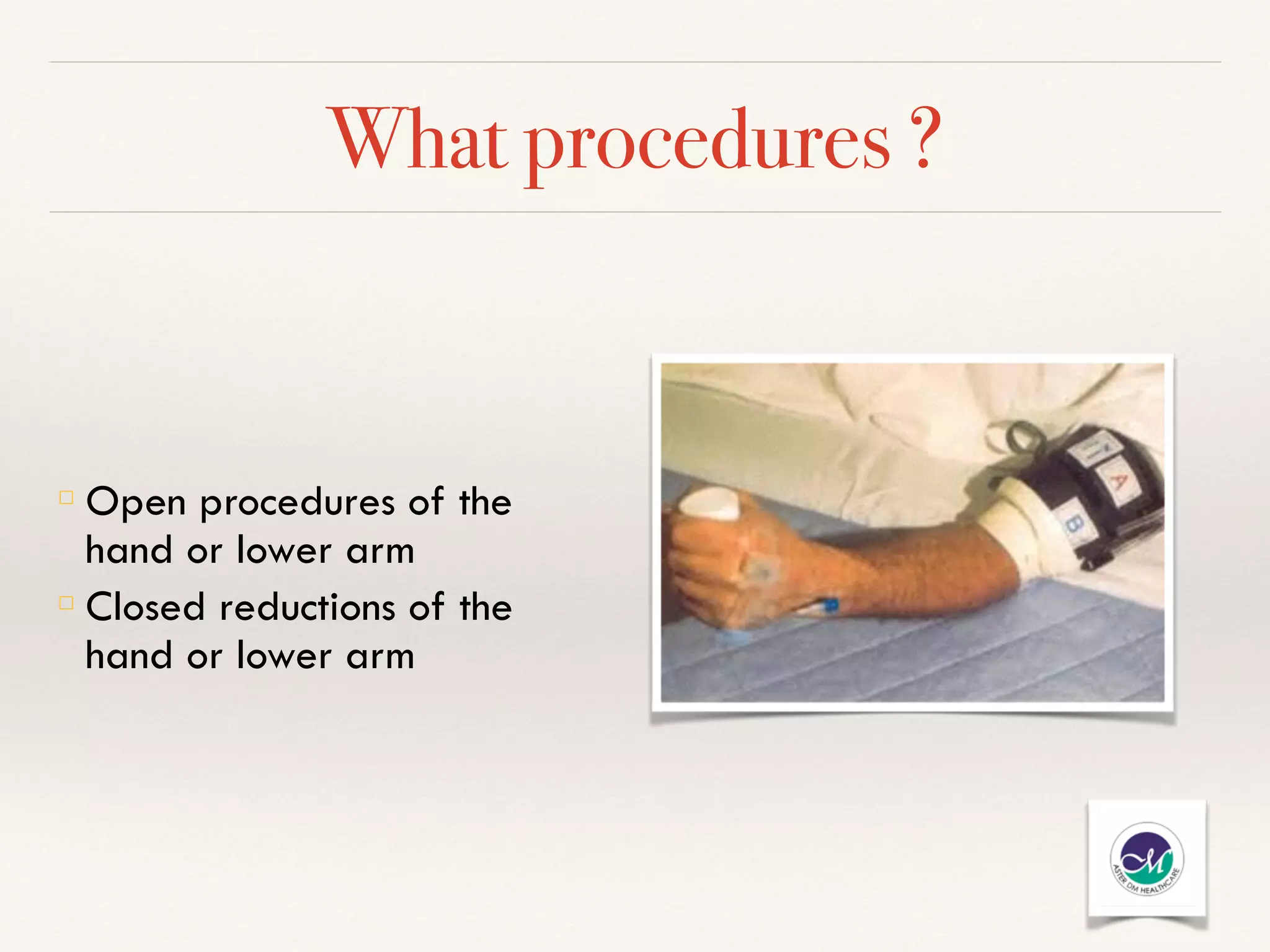 Fascia Iliaca and Biers blocks in Emergency room | PDF