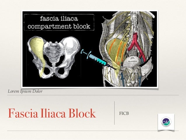 Fascia Iliaca and Biers blocks in Emergency room