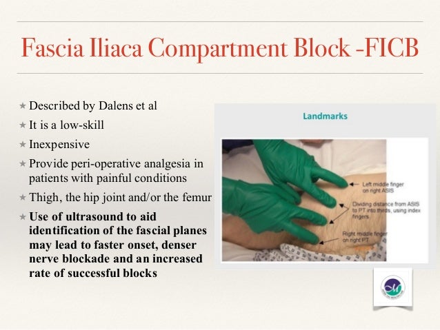 Fascia Iliaca and Biers blocks in Emergency room