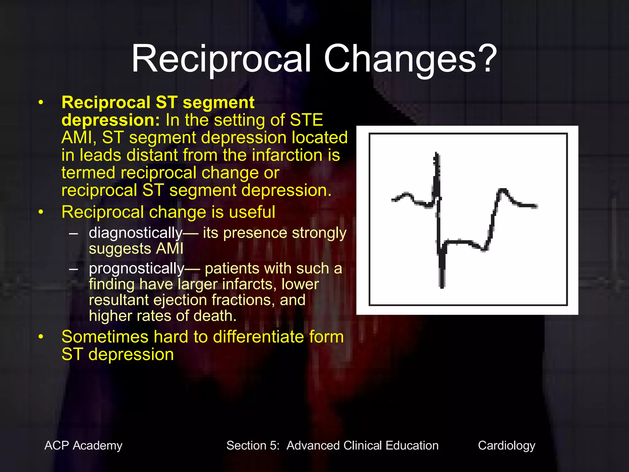 STEMI, N-STEMI, and Everything else | PPT