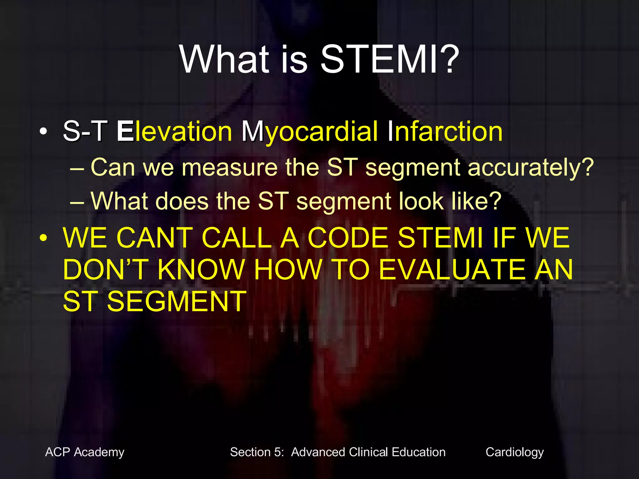 STEMI, N-STEMI, and Everything else | PPT