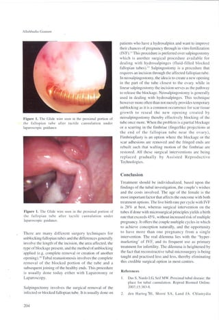 Blocked fallopian tubes treatment options | PDF | Infertility ...