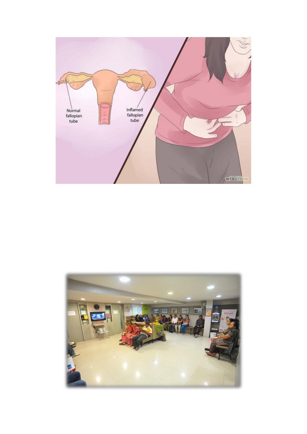 Fallopian Tube Procedures for Infertility