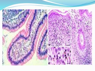 BLOCK PREPARATION.pptx