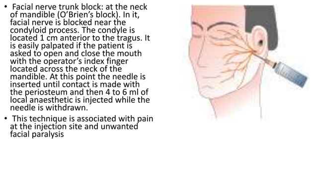 BLOCKS AND MODERN IOL different types and iols | PPT