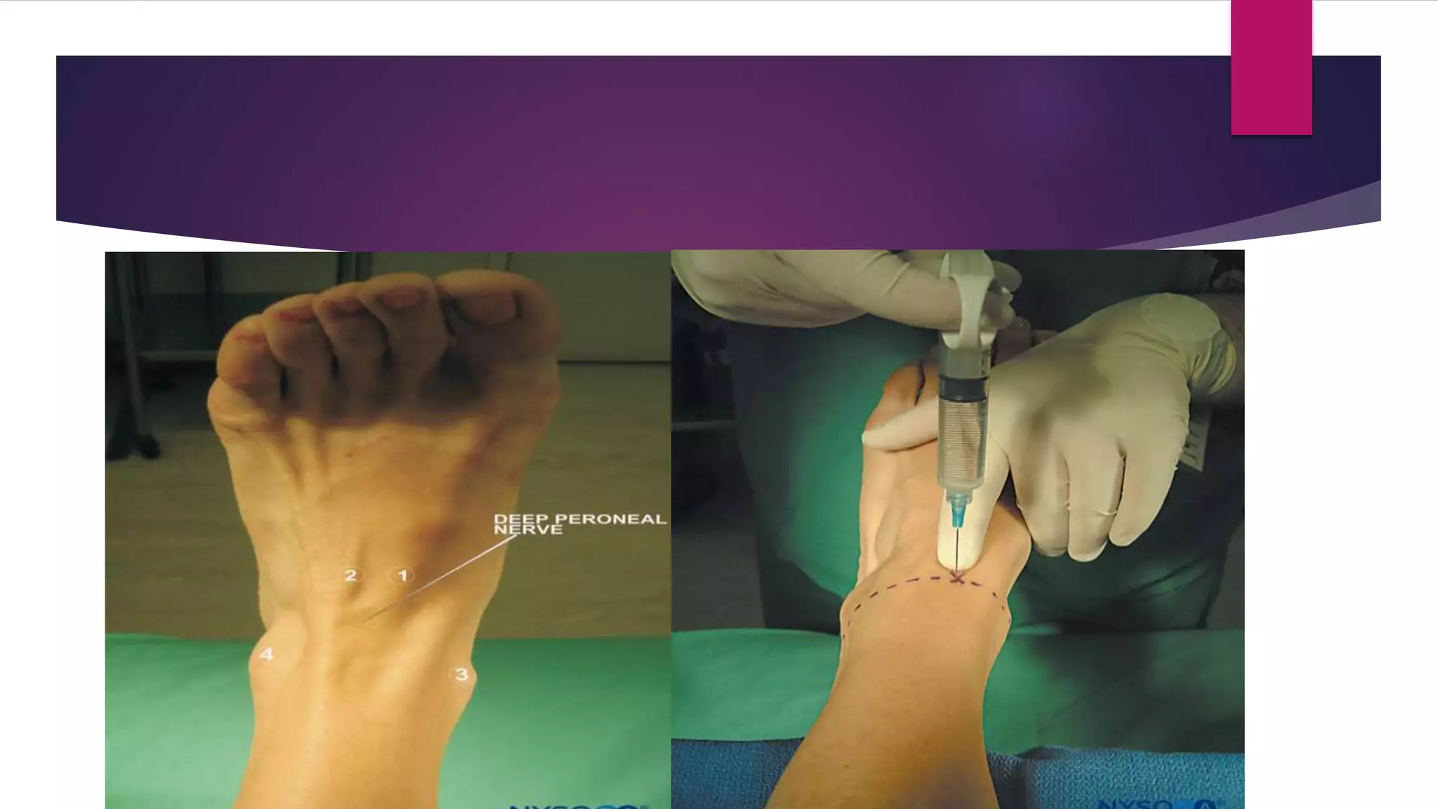 Blocks Lower limb.pptx