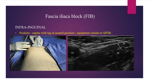 Blocks Lower limb.pptx
