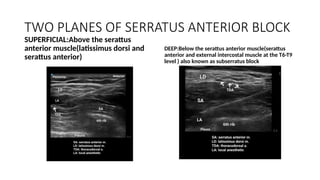 BLOCKS OF CHEST WALL IN ANESTHESIA 1.pptx