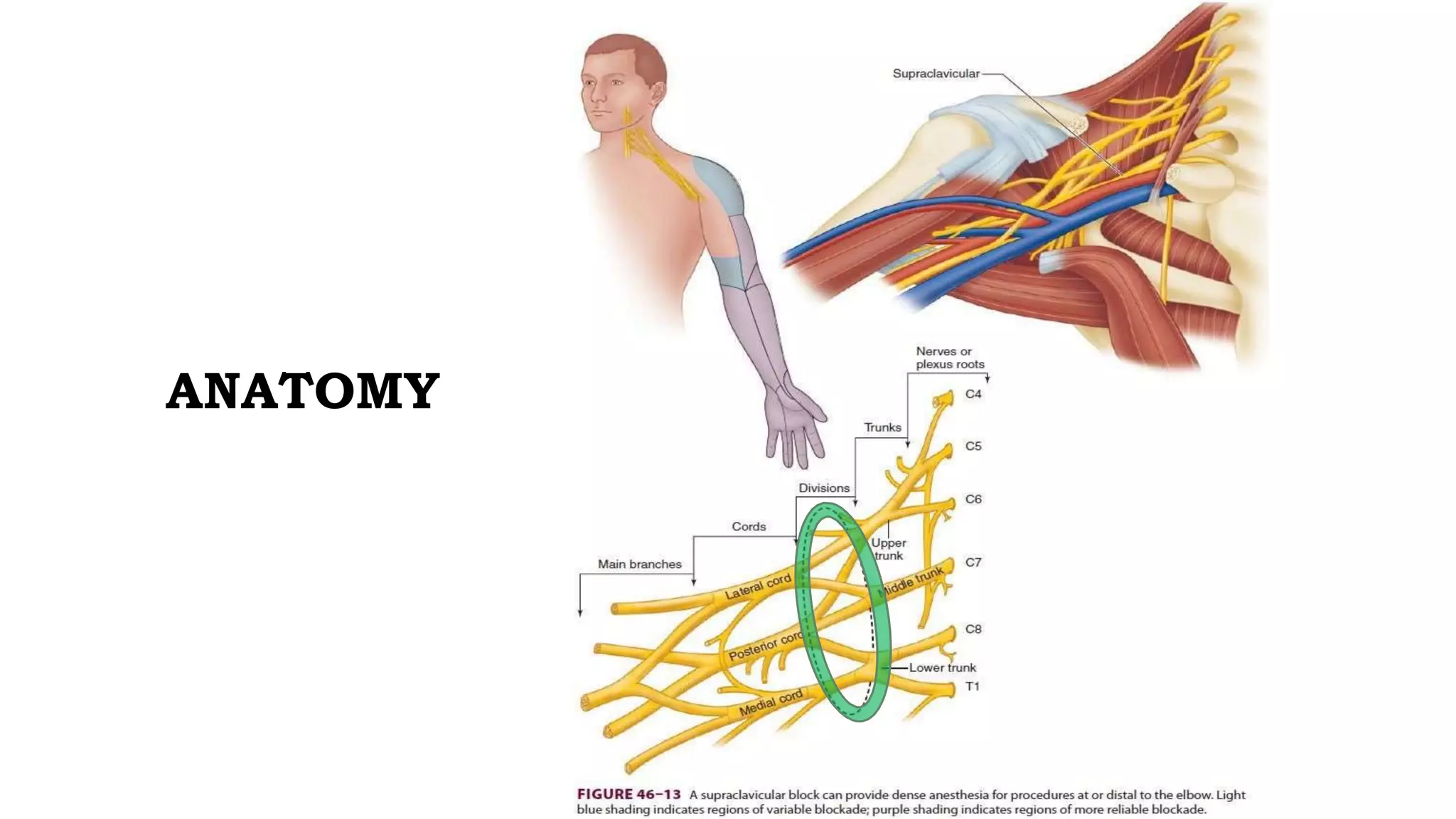 Blocks upper limb anesthesia | PPTX