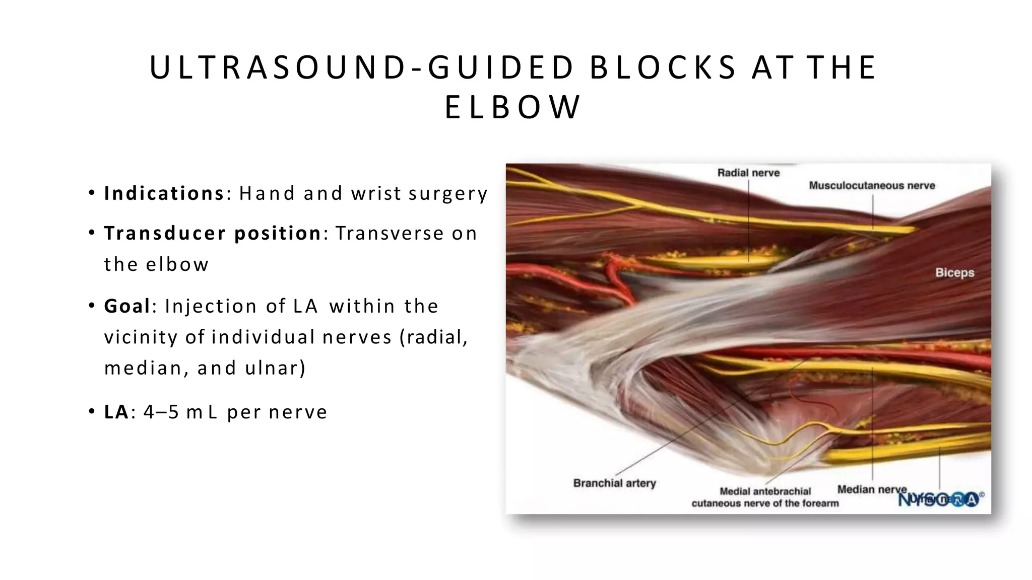 Blocks upper limb anesthesia | PPTX