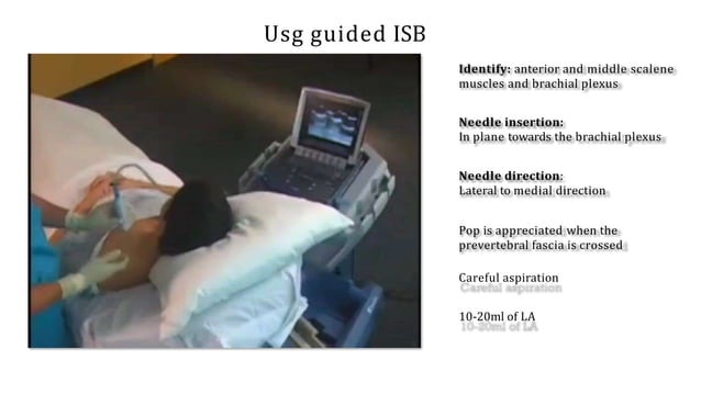 Blocks upper limb anesthesia | PPTX