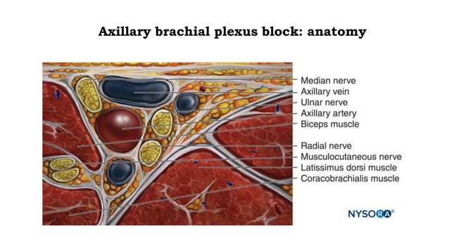 Blocks upper limb anesthesia | PPTX