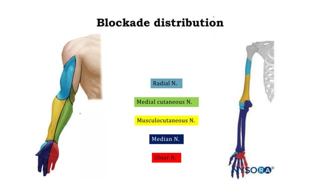 Blocks upper limb anesthesia | PPTX
