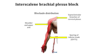 Interscalene Block Distribution