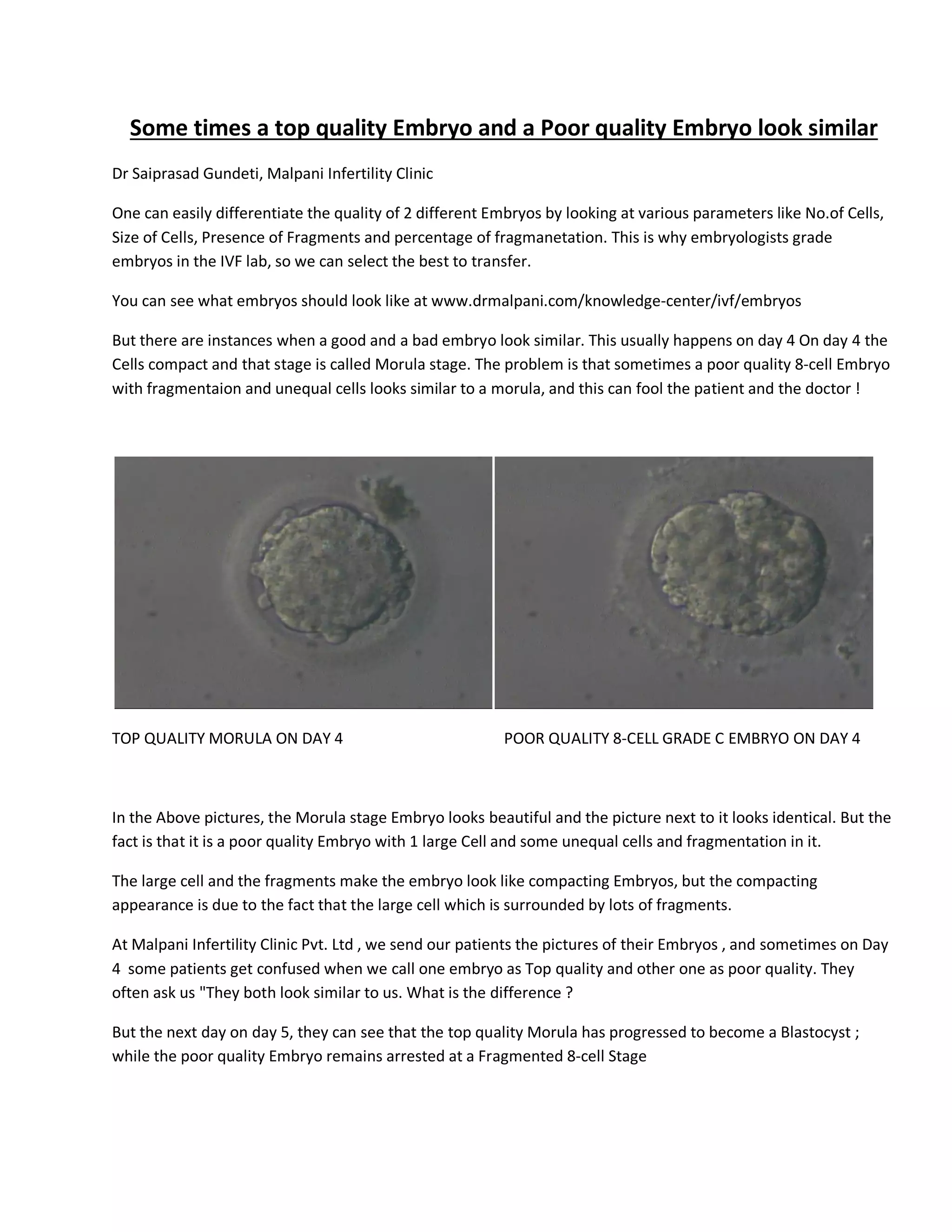 When a top quality embryo and poor quality embryo look similar | PDF