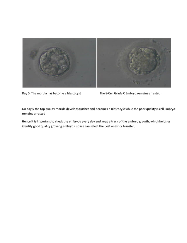 When a top quality embryo and poor quality embryo look similar | PDF ...