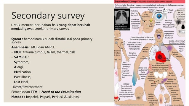 primary and secondary survey in emergency | PPTX