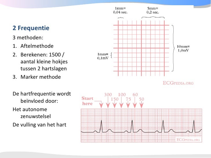 Introductie ECG