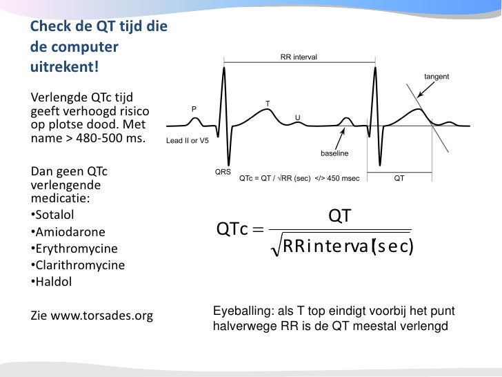 Introductie ECG