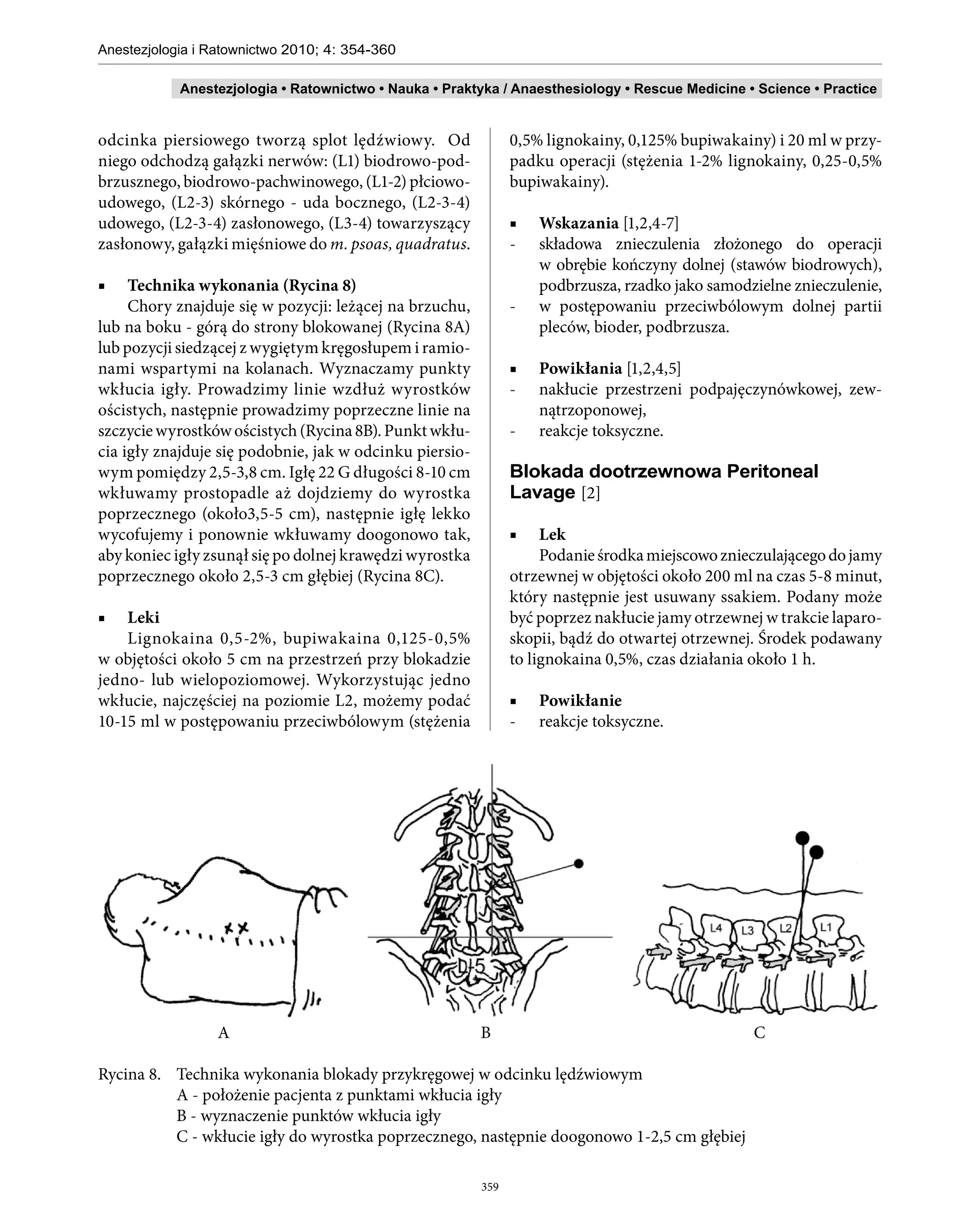 Blokady regionalne: klp, plecy, brzuch | PDF