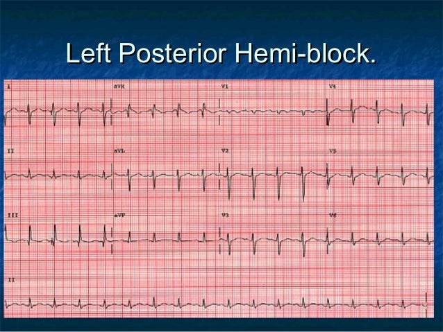 Blood supply of heart (1)