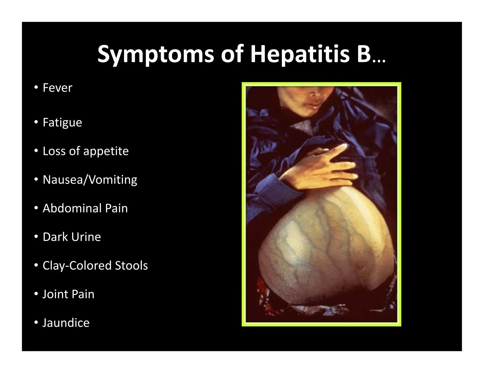 Blood-borne-Pathogen-Presentation-PDF.pdf