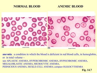Chapter 14 - Blood | PPT