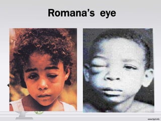 Blood flagellates-haemoflagellates | PPTX