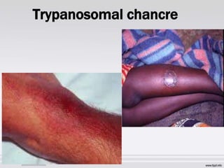 Blood flagellates-haemoflagellates | PPTX