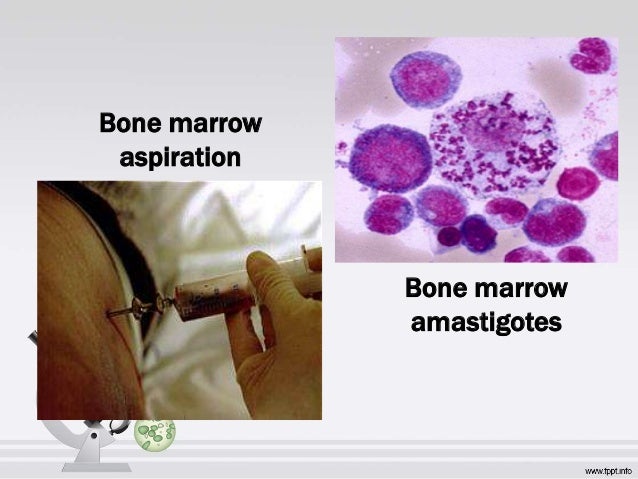Blood flagellates-haemoflagellates