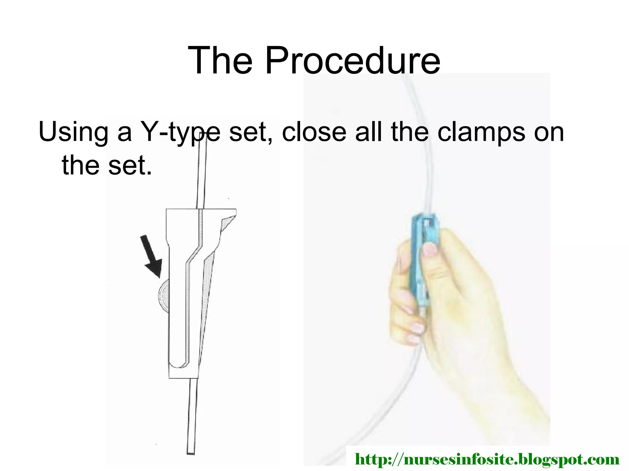 Blood Transfusion (a nursing procedure) by www.nursesinfosite.blogspot.com