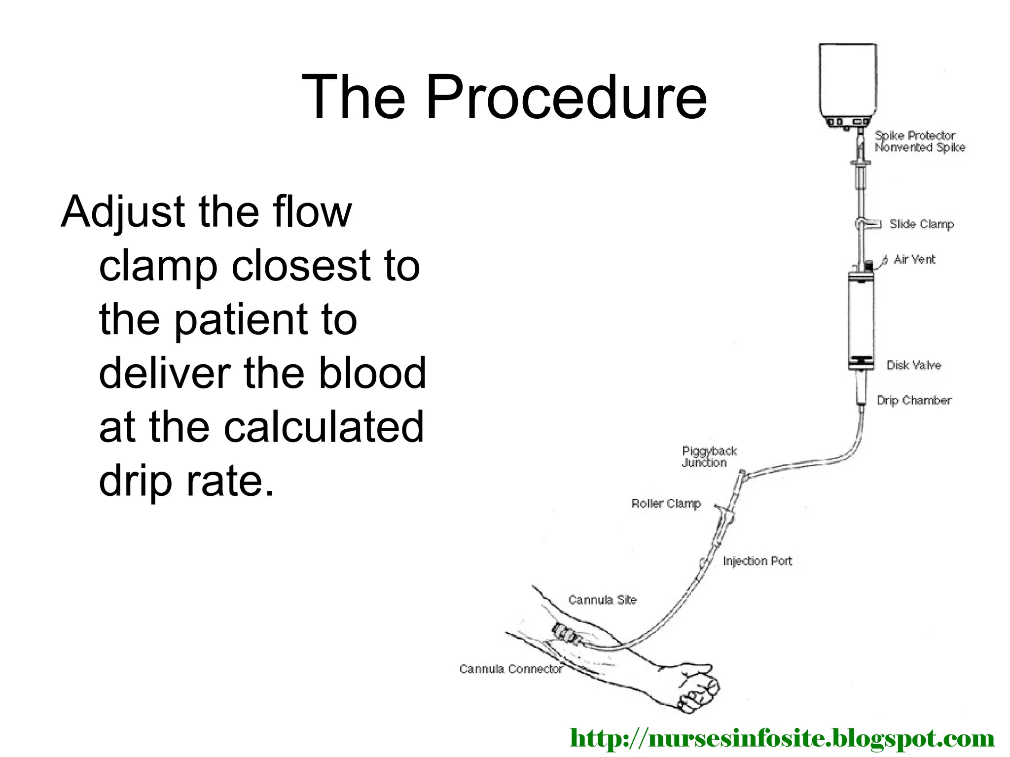 Blood Transfusion (a nursing procedure) by www.nursesinfosite.blogspot.com
