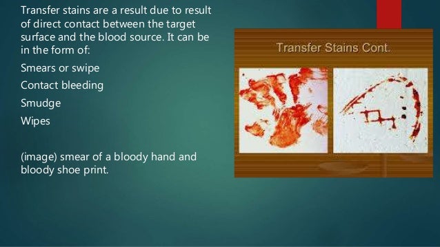 Bloodstain pattern analysis