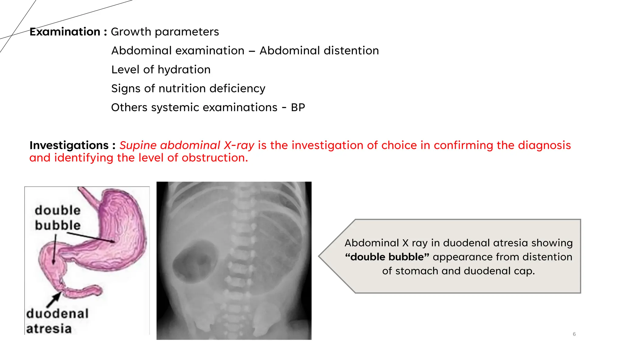 Blood and Bile-stained vomiting in pediatrics.pdf